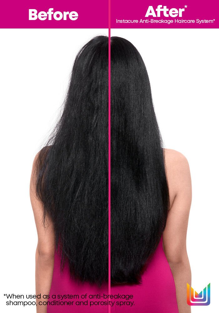 Matrix Instacure Tension Reliever