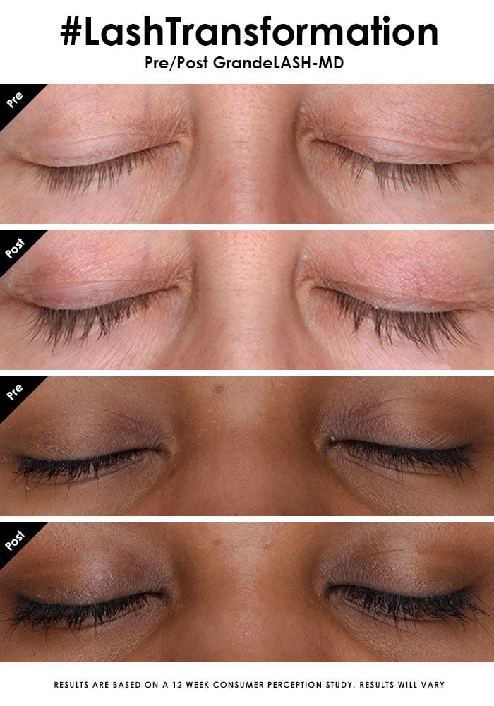 Grande Cosmetics GrandeLASH-MD Lash Enhancing Serum | SalonCentric